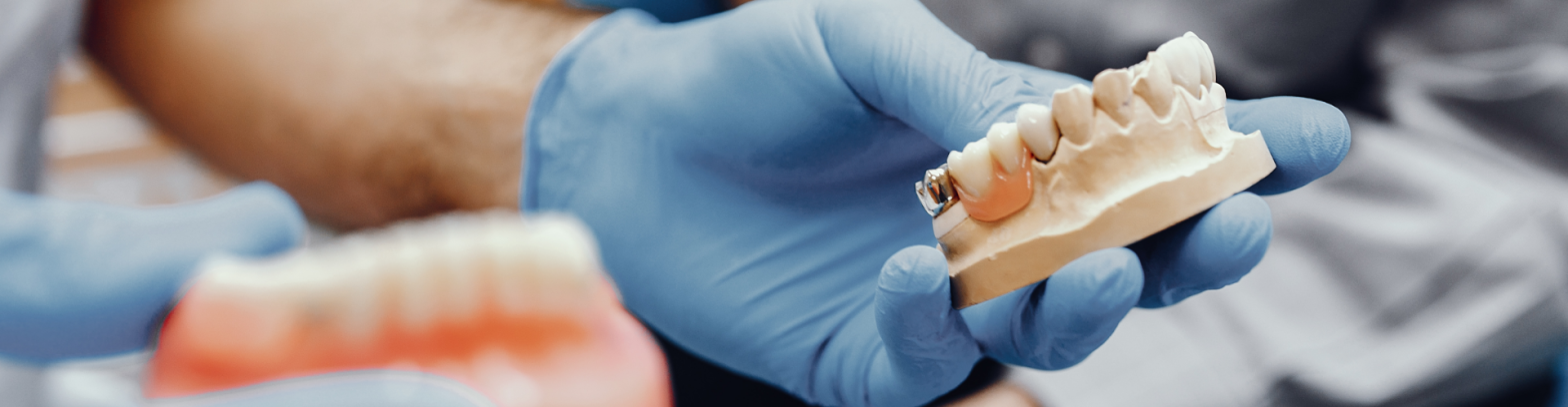 Implant Supported Dentures for Natural Smiles | Tooth Stories